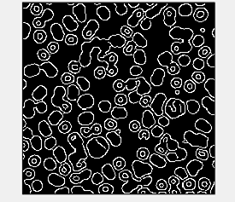 GitHub - Crackeree/Automatic-platelet-count-based-on-morphological-segmentation-technique-from ...