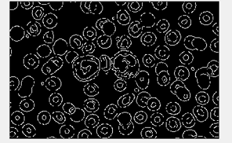 GitHub - Crackeree/Automatic-platelet-count-based-on-morphological-segmentation-technique-from ...