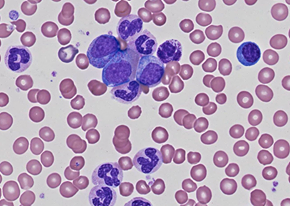 GitHub - Crackeree/Automatic-platelet-count-based-on-morphological-segmentation-technique-from ...