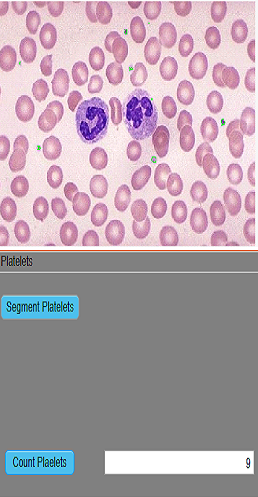 GitHub - Crackeree/Automatic-platelet-count-based-on-morphological-segmentation-technique-from ...