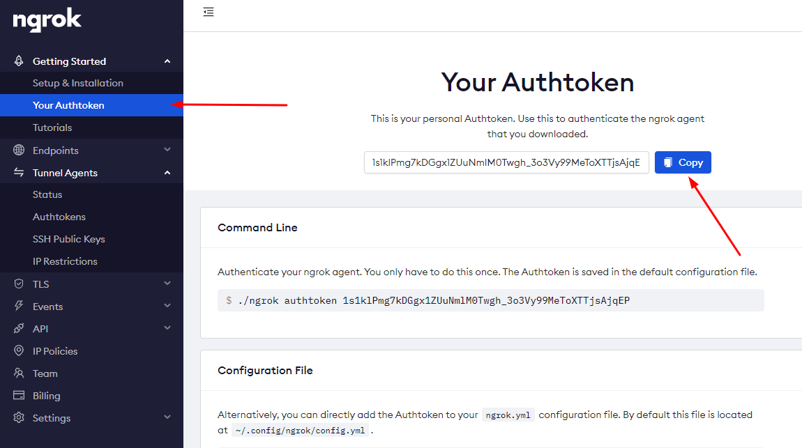 GitHub - AlexandreGuirado/Streamlit-Iris-RandomForest-App
