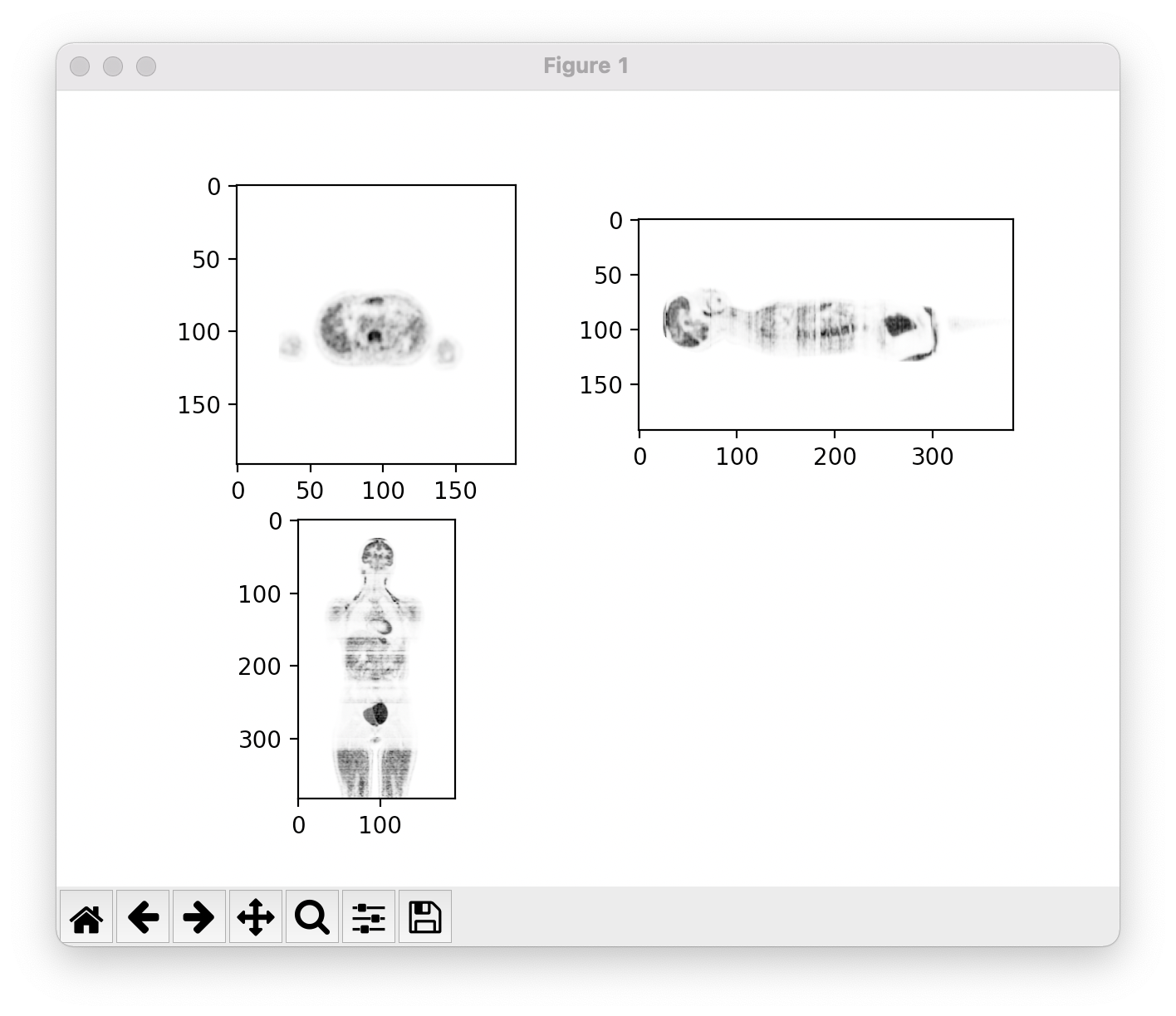 Image Looks Sliced · Issue 1318 · Pydicom Pydicom · Github
