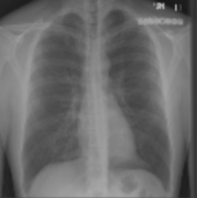 GitHub - asd08573064/Automatic-Medical-Report-Generator