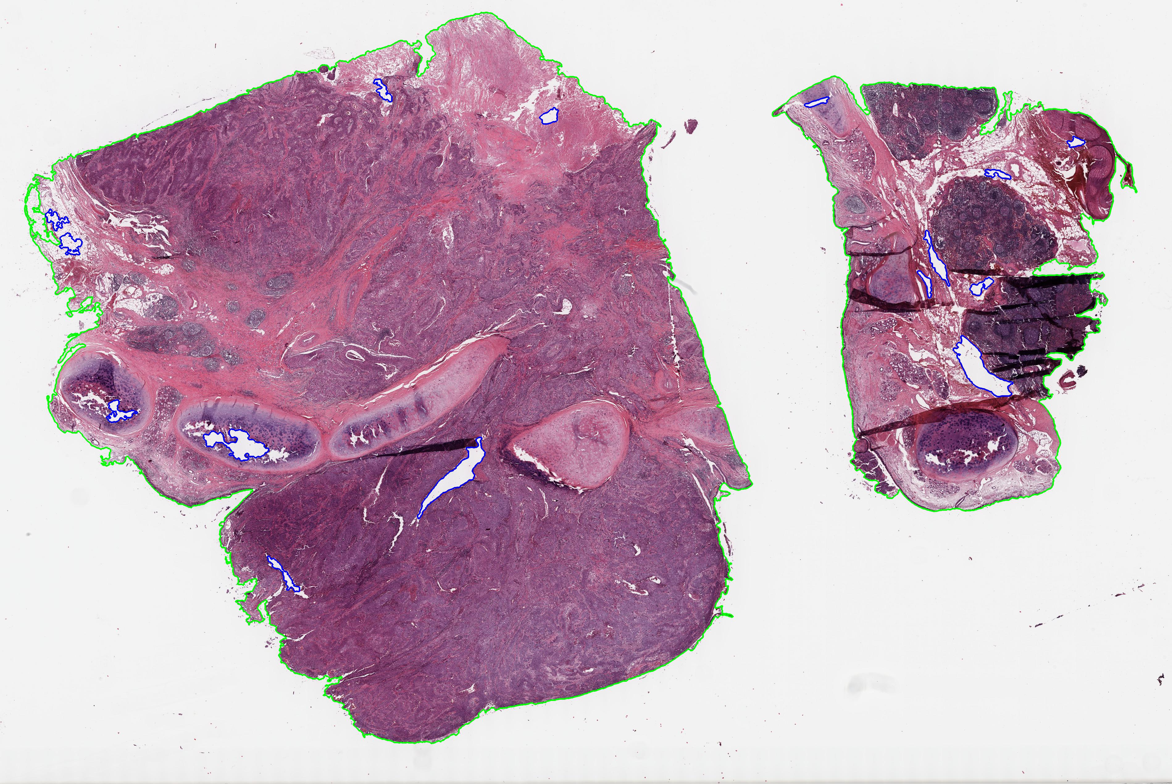 The "flaw" in stiches · Issue #71 · mahmoodlab/CLAM · GitHub
