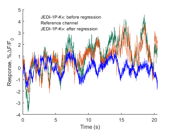 GitHub - JaegerLab/JEDI-1P-Kv_widefield_imaging_preprocessing_pipeline: Preprocessing pipeline ...