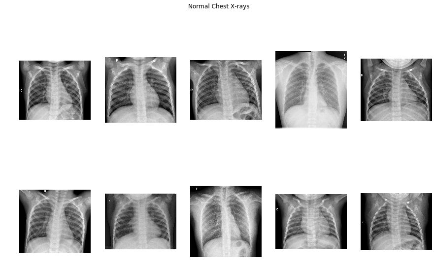 GitHub - timav2403/Detecting_Abnormalities_in_Chest_X_rays