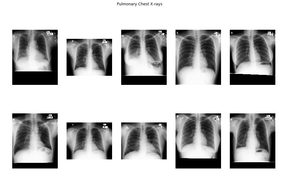 GitHub - timav2403/Detecting_Abnormalities_in_Chest_X_rays