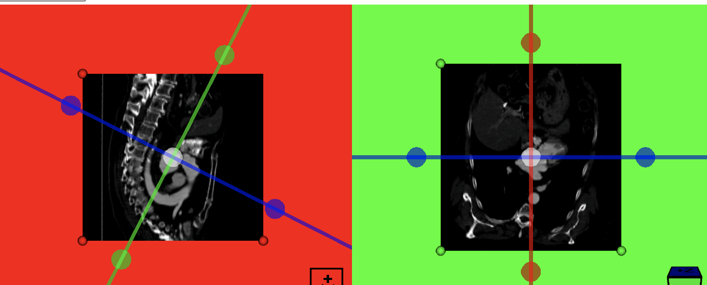 Improvements To Reslicecursorwidget · Issue 2461 · Kitware Vtk Js · Github