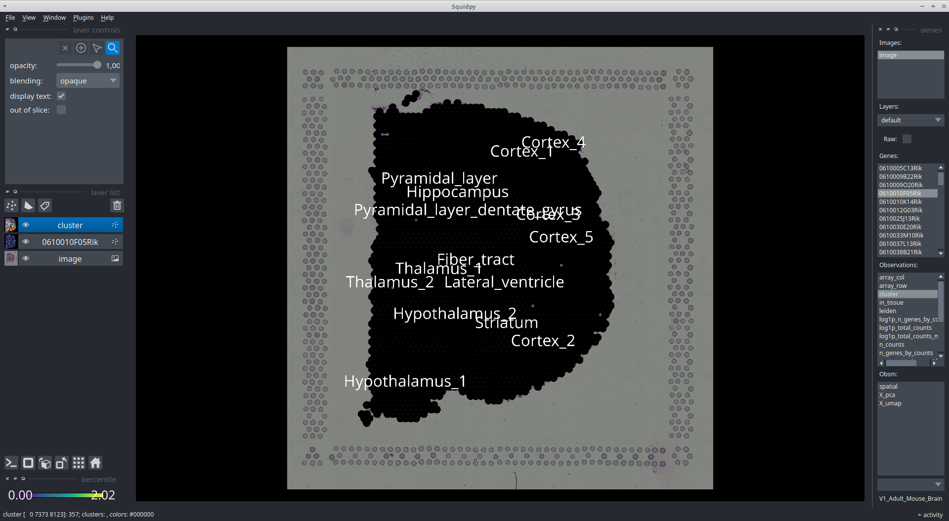 Error when selecting gene expression using interactive viewer · Issue #485 · scverse/squidpy ...