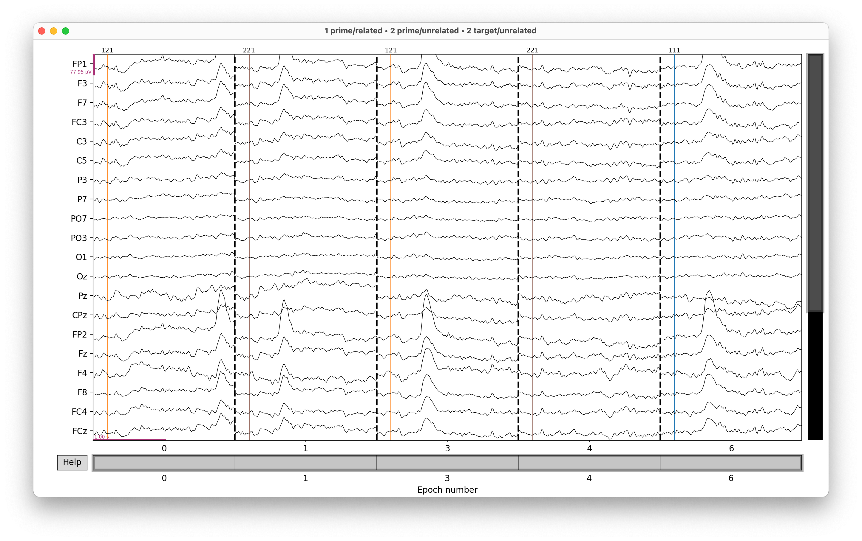 Should `mneepochsplot` Plot Events And Ids By Default · Issue