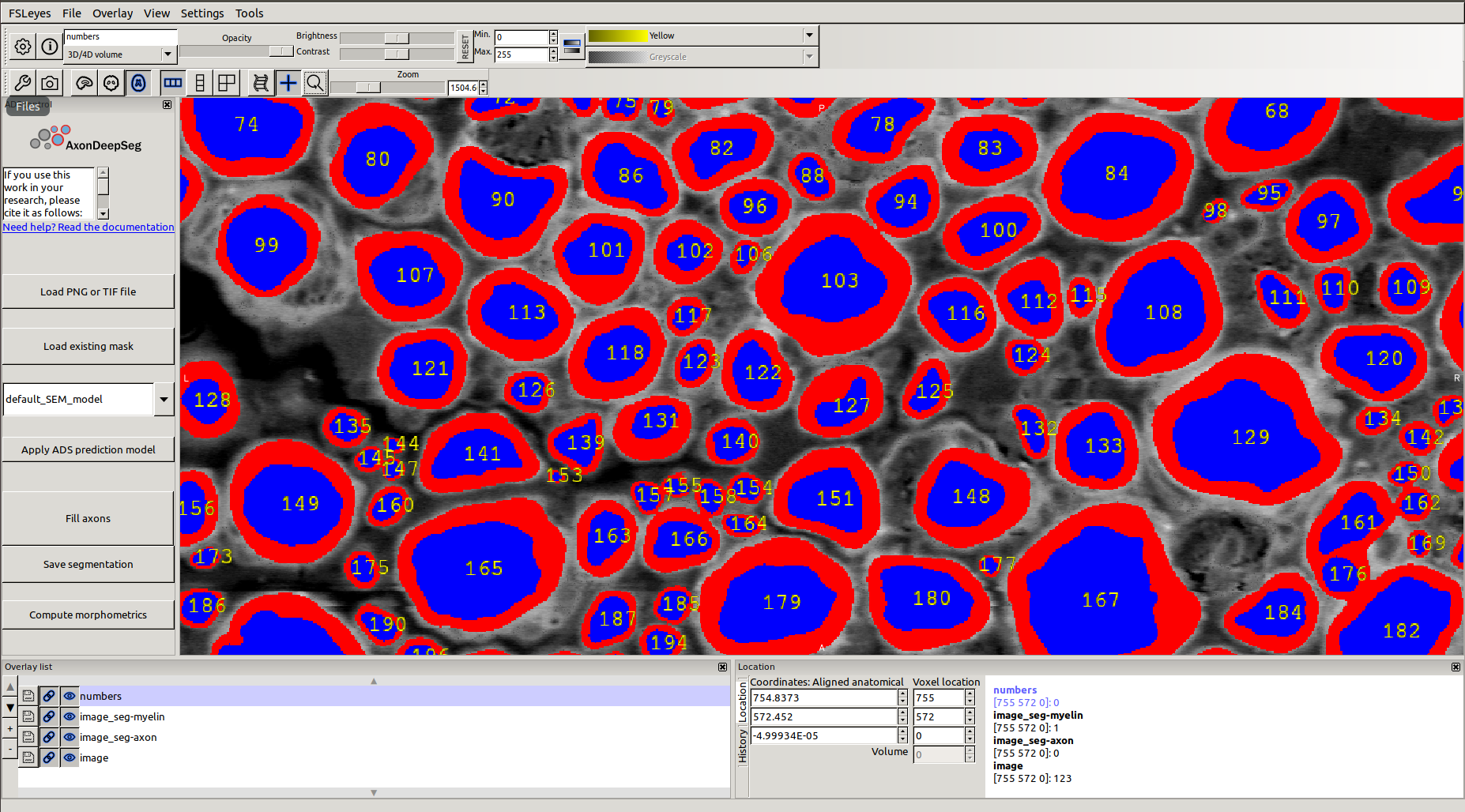 FSLeyes: Overlay axon numbers on the image · Issue #341 · axondeepseg ...