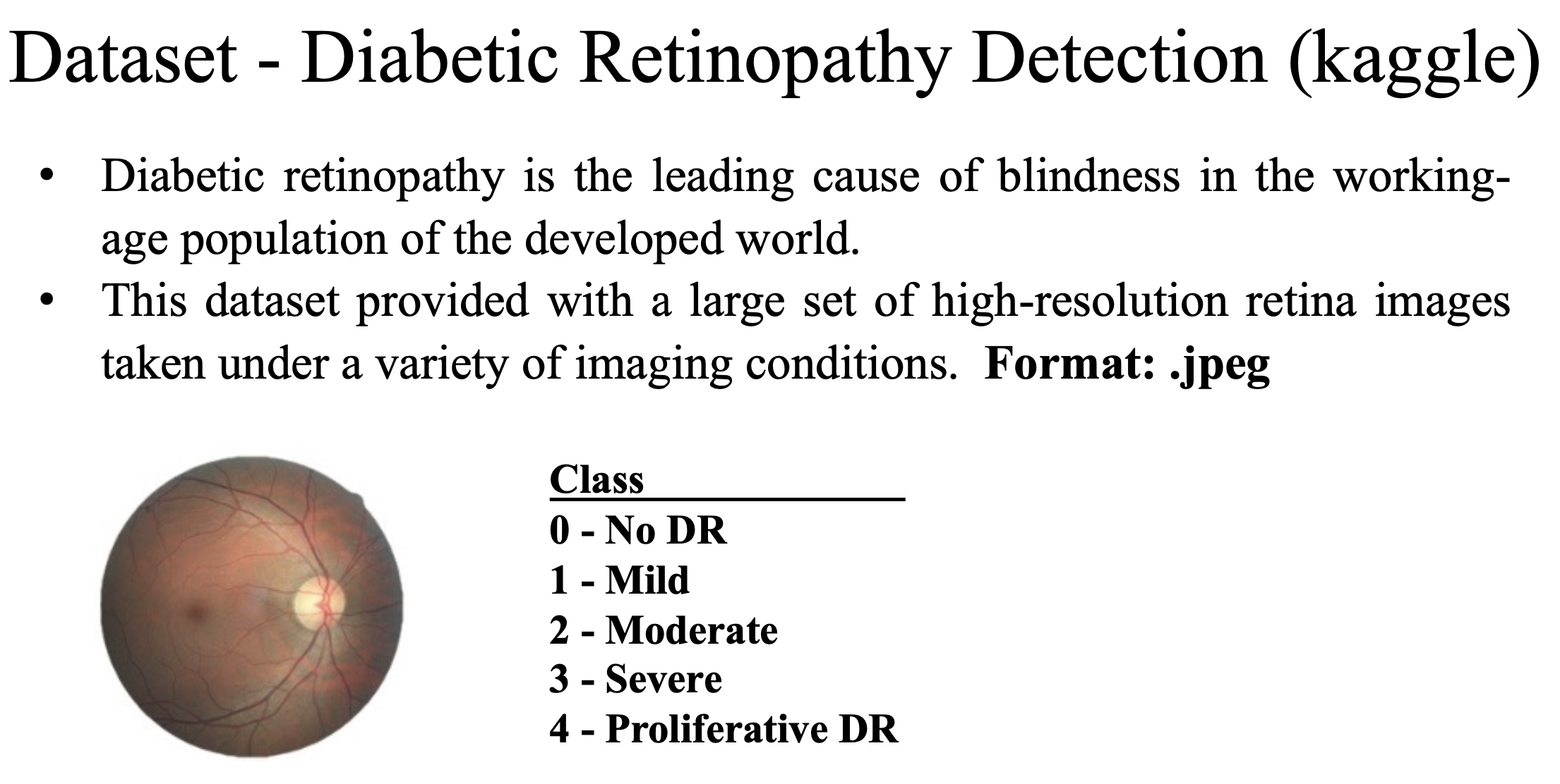 GitHub - jeannineshiu/Diabetic-Retinopathy-Detection: NYCU Deep Learning Course