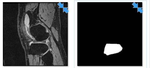 Github Nilesh7889deep Learning For Tibia Bone Segmentation Using U
