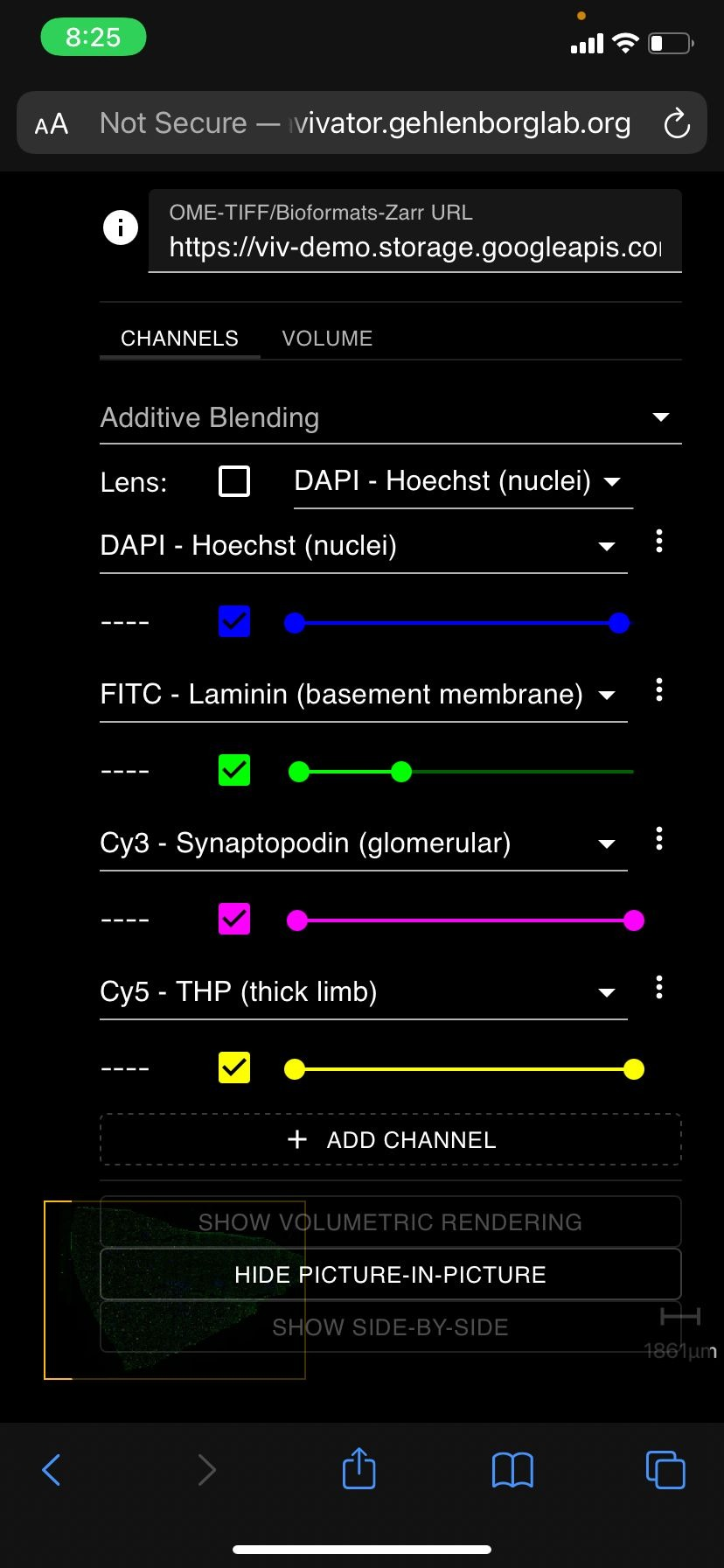 Inteprolation Feature Broke Mobile Viv (on Iphone) · Issue #456 · hms-dbmi/viv · GitHub