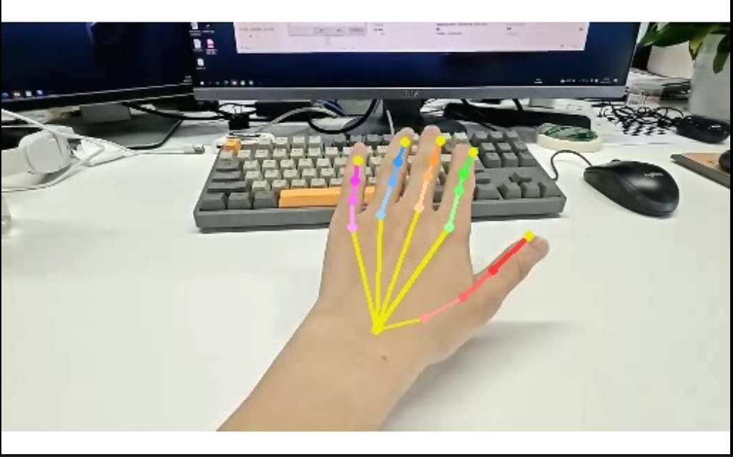 It seems that ACR does not perform well on single-hand image · Issue ...