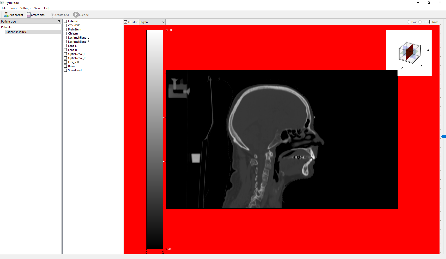 Fix canvas layout · Issue #429 · pytrip/pytripgui · GitHub