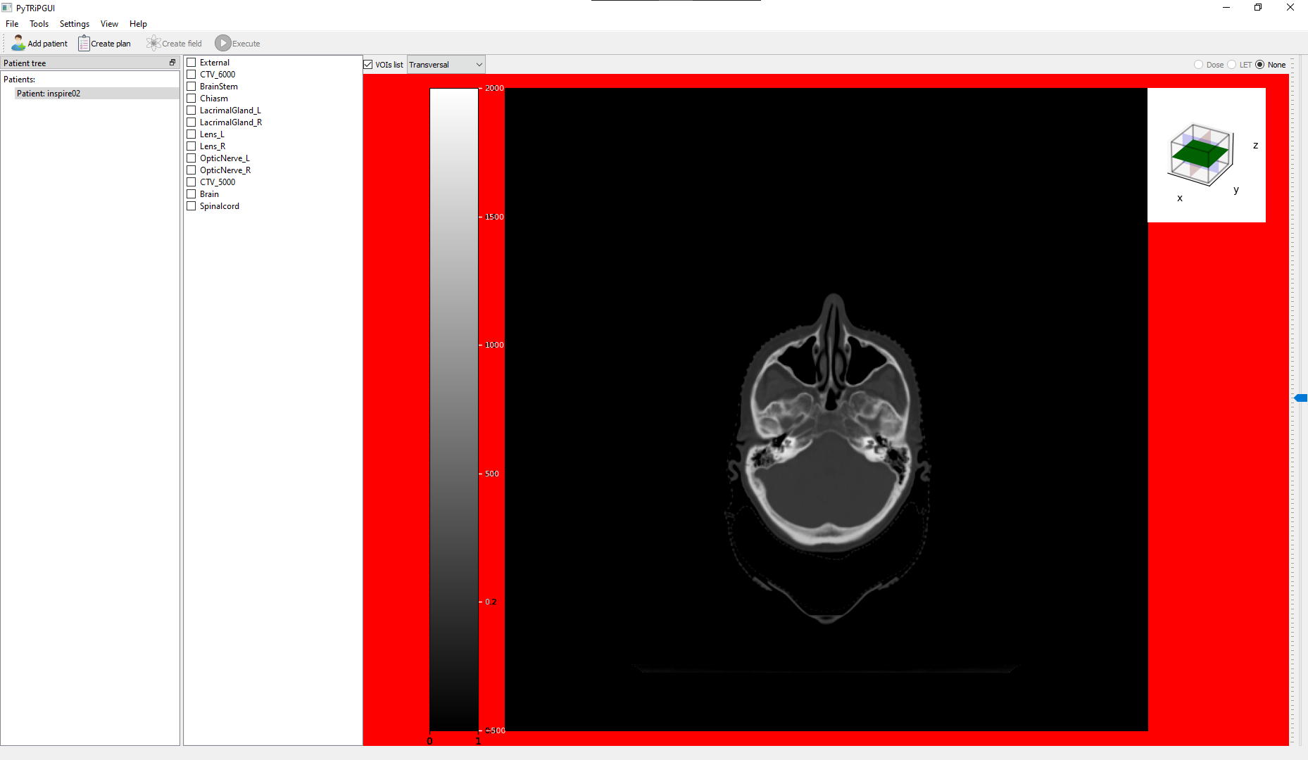 Fix canvas layout · Issue #429 · pytrip/pytripgui · GitHub