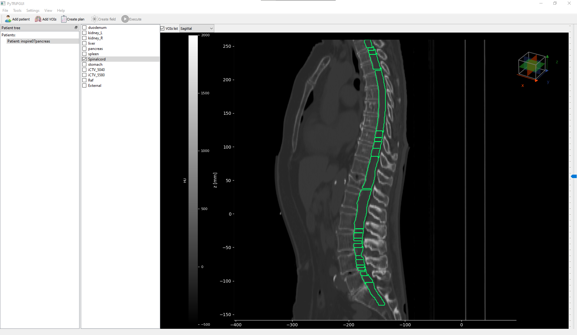 Intersections are not calculated properly · Issue #665 · pytrip/pytrip · GitHub
