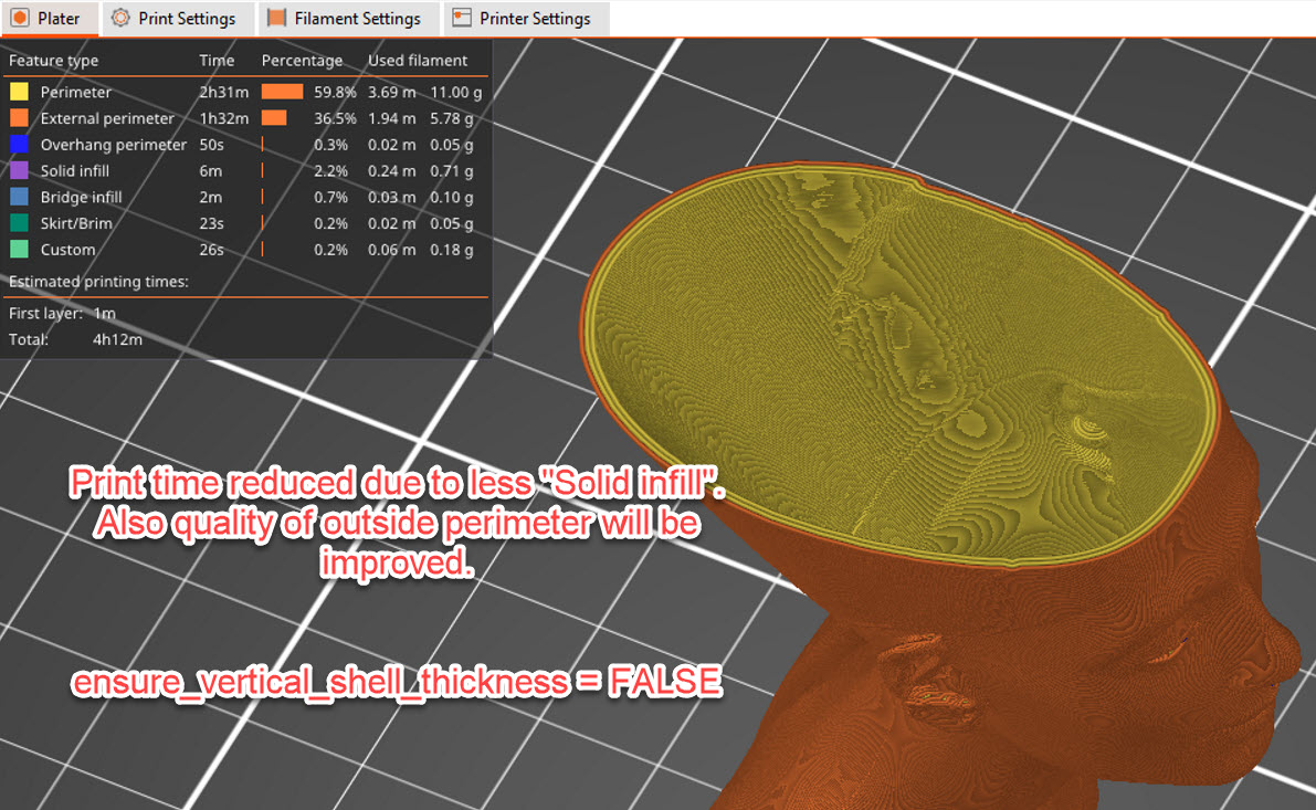 [Feature Request] Make ensure_vertical_shell_thickness and more quality parameter user ...