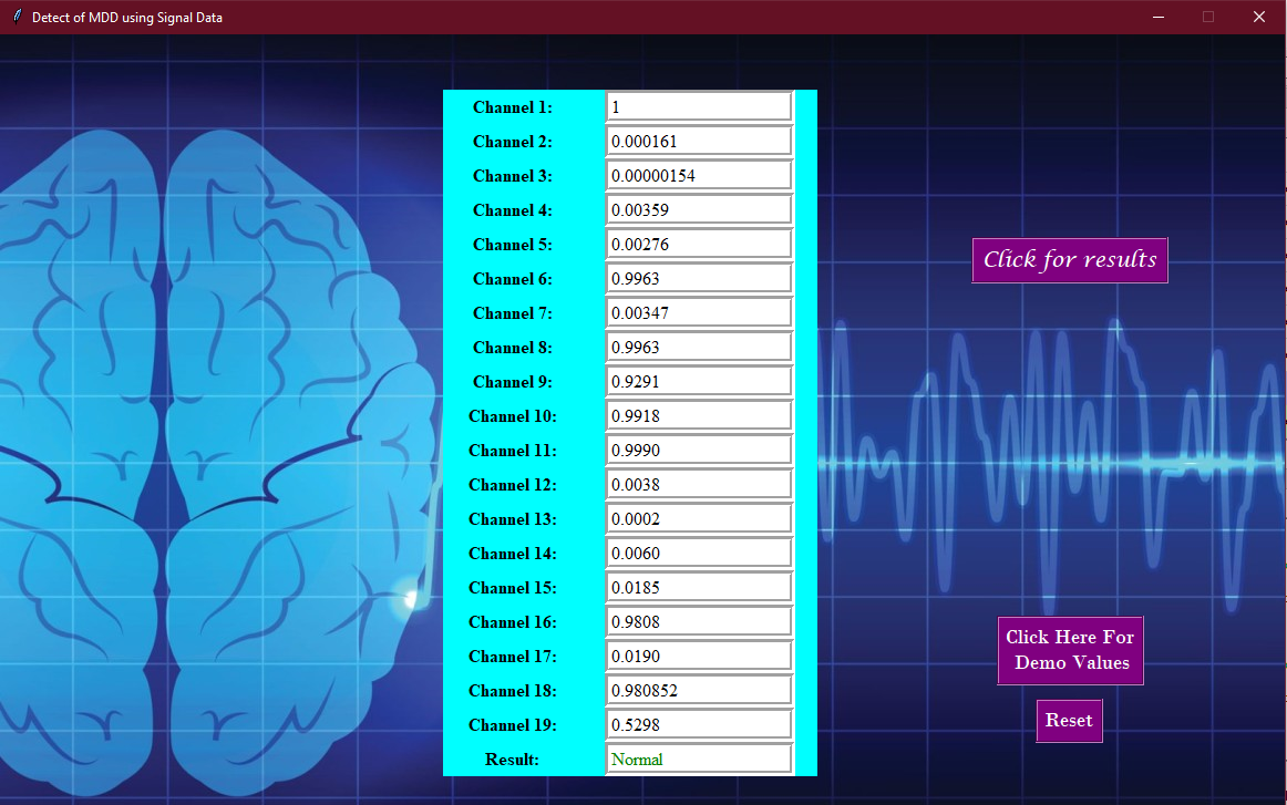 GitHub - axelblaze11/Expert-System-On-Major-Depressive-Disorder-using ...