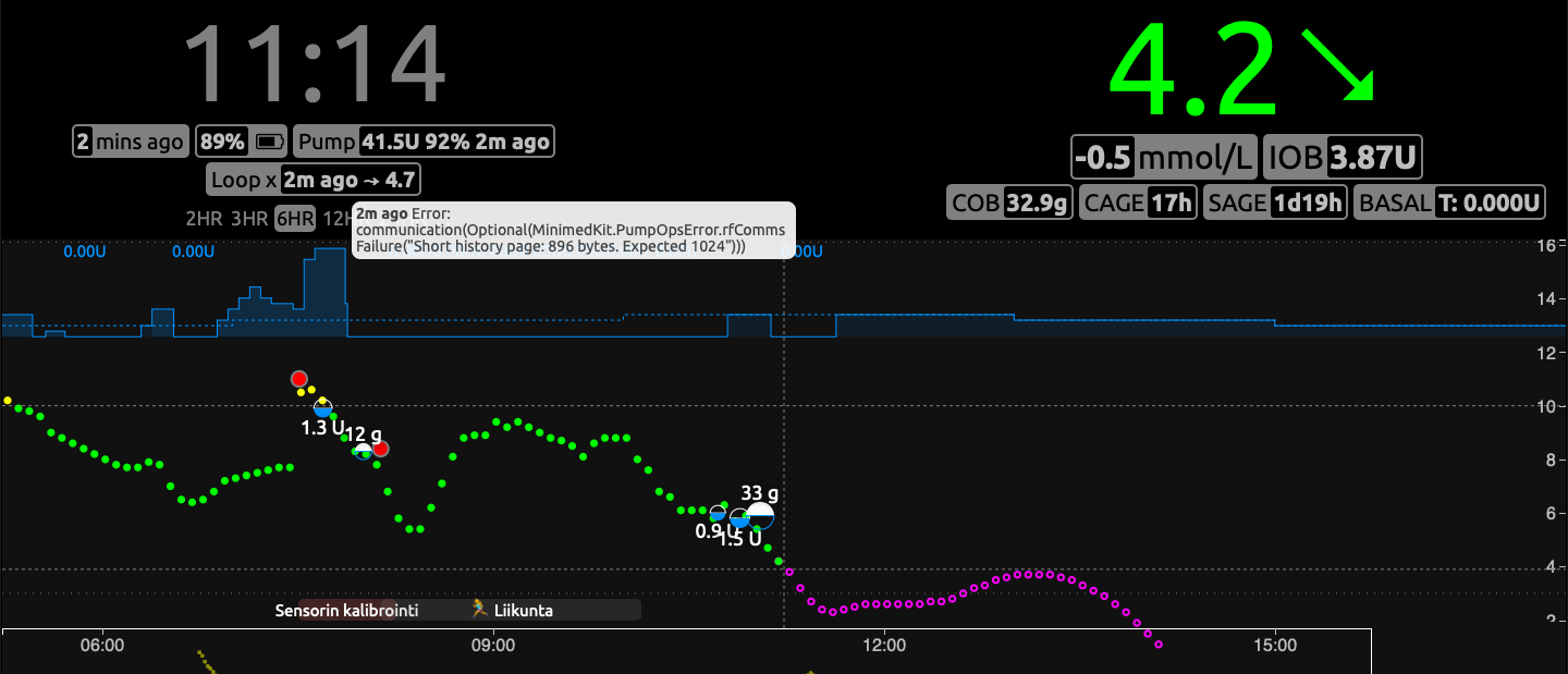 Resume missing from history · Issue #1133 · LoopKit/Loop · GitHub