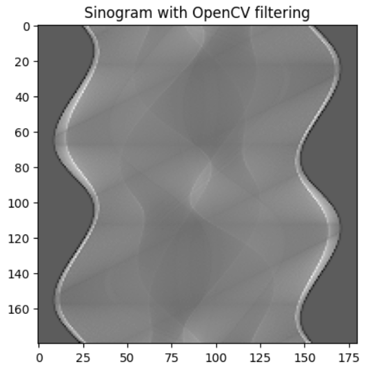 GitHub - HelenaMaslowska/Tomograph: Tomograph - Radon transform experiment.