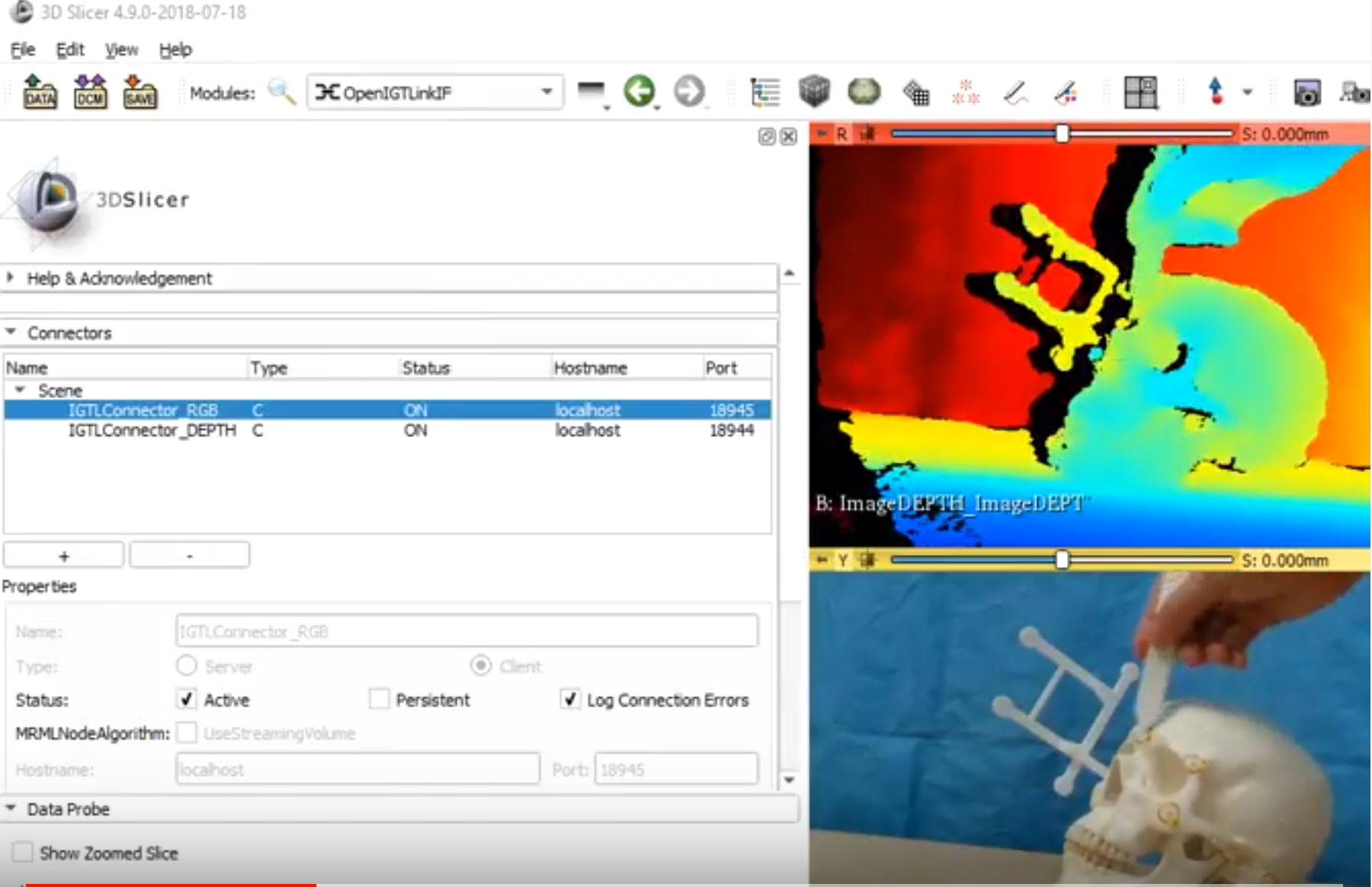 Intel Realsense for Point cloud Acquisition · Issue #616 · PlusToolkit ...