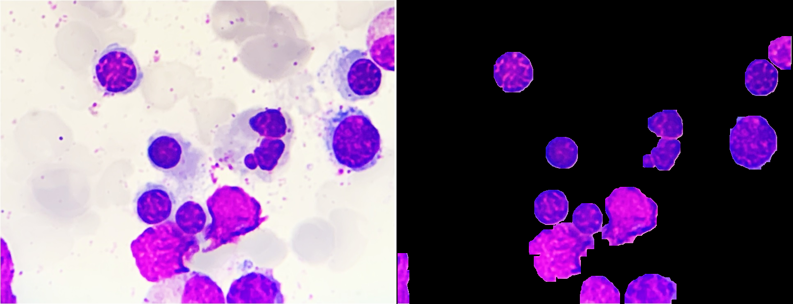 GitHub - amartyacodes/Segmentation-of-Cells: Segmenting Cells from ...