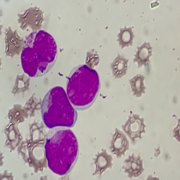GitHub - amartyacodes/Unsupervised-WBC-Segmentation: Segmentation of White Blood Cells using ...