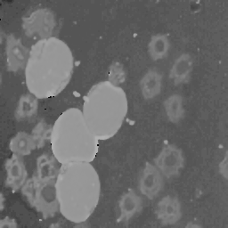 GitHub - amartyacodes/Unsupervised-WBC-Segmentation: Segmentation of White Blood Cells using ...