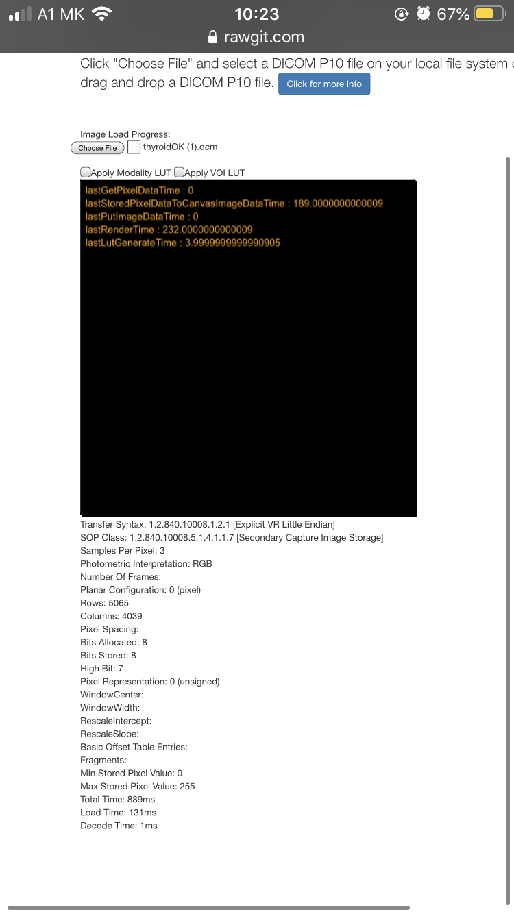Some dicom images are not showing in the viewer · Issue #324 · cornerstonejs ...