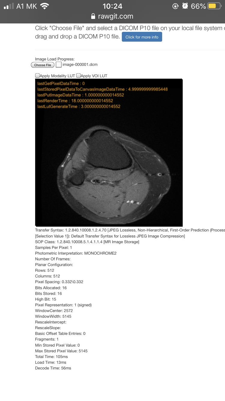 Some dicom images are not showing in the viewer · Issue #324 · cornerstonejs ...