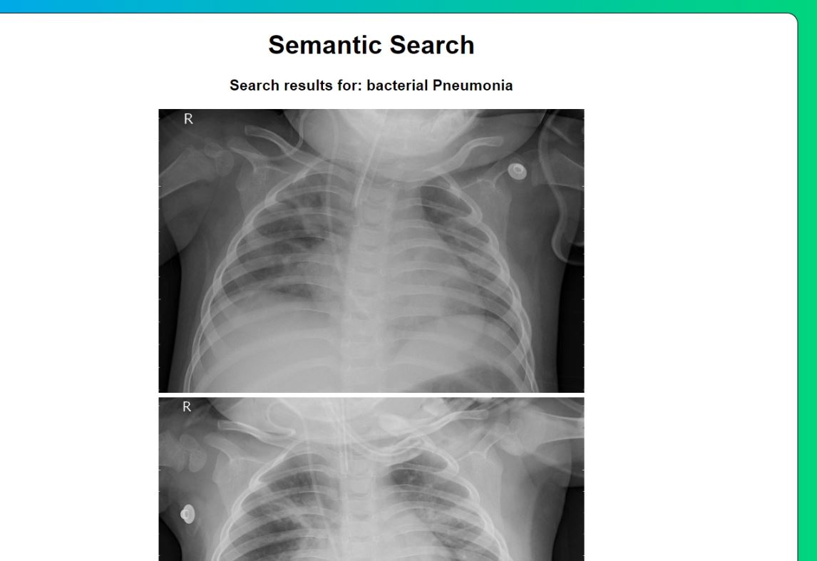GitHub - rishabhdhenkawat/image-captioning-using-inception-v3-and-beam-search