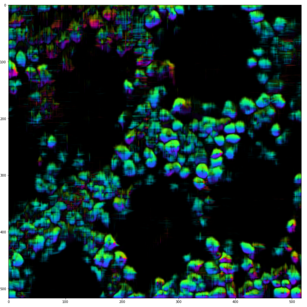 Striking artifact on 3d segmentation · Issue #503 · MouseLand/cellpose · GitHub