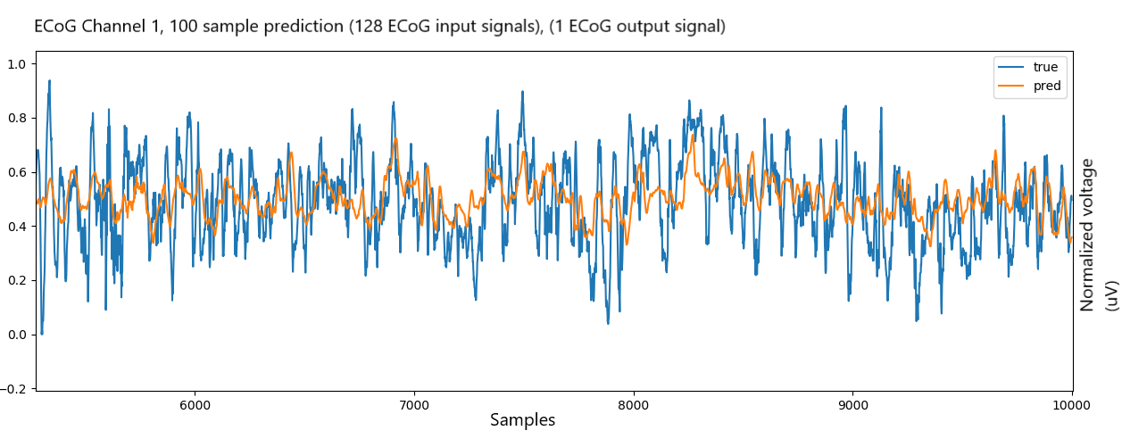 GitHub - KieranMills/EEG_and_ECOG: Code base surrounding my thesis on simultaneous EEG and ECOG ...