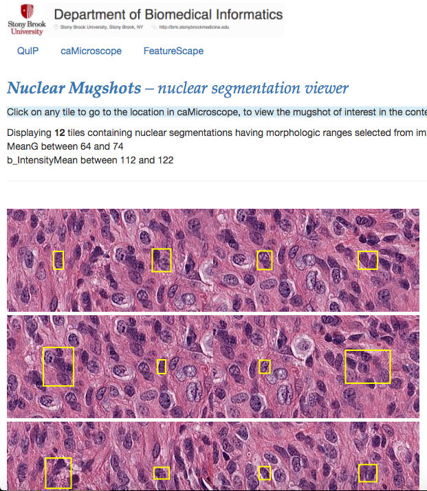 caMicroscope/mugshot viewer: identify location · Issue #100 · SBU-BMI/quip_distro · GitHub
