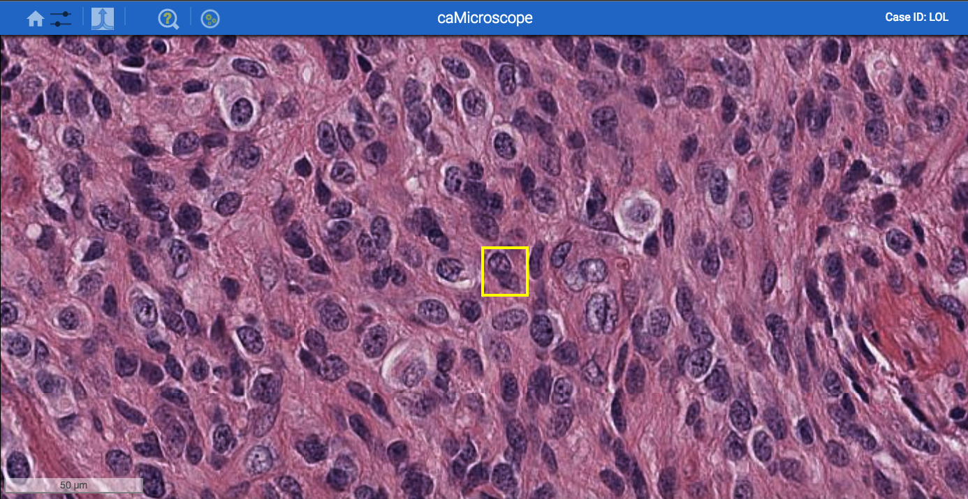 caMicroscope/mugshot viewer: identify location · Issue #100 · SBU-BMI/quip_distro · GitHub