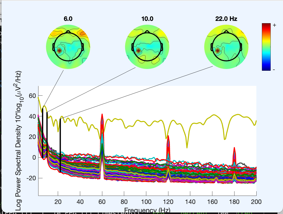 Implement parrallel loop for spectopo · Issue #572 · sccn/eeglab · GitHub