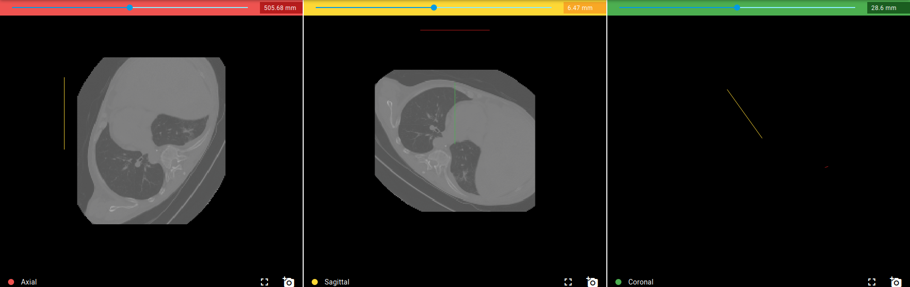 VTK Image Mapper compute closest IJK Axis fails for this case · Issue ...