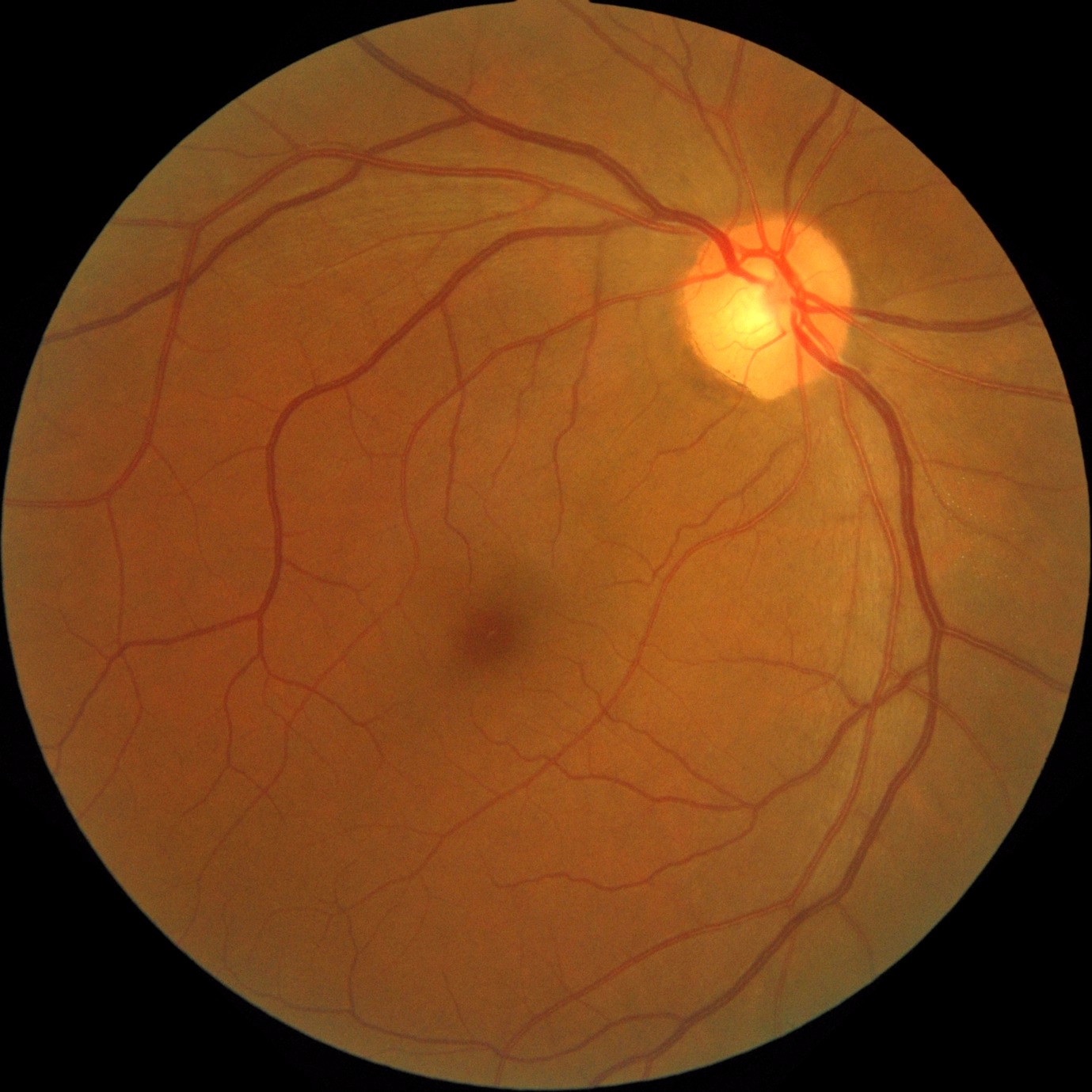 Unable To Generate Images In Tensor Board Using Keras Showing Only Black And Grey Coloured