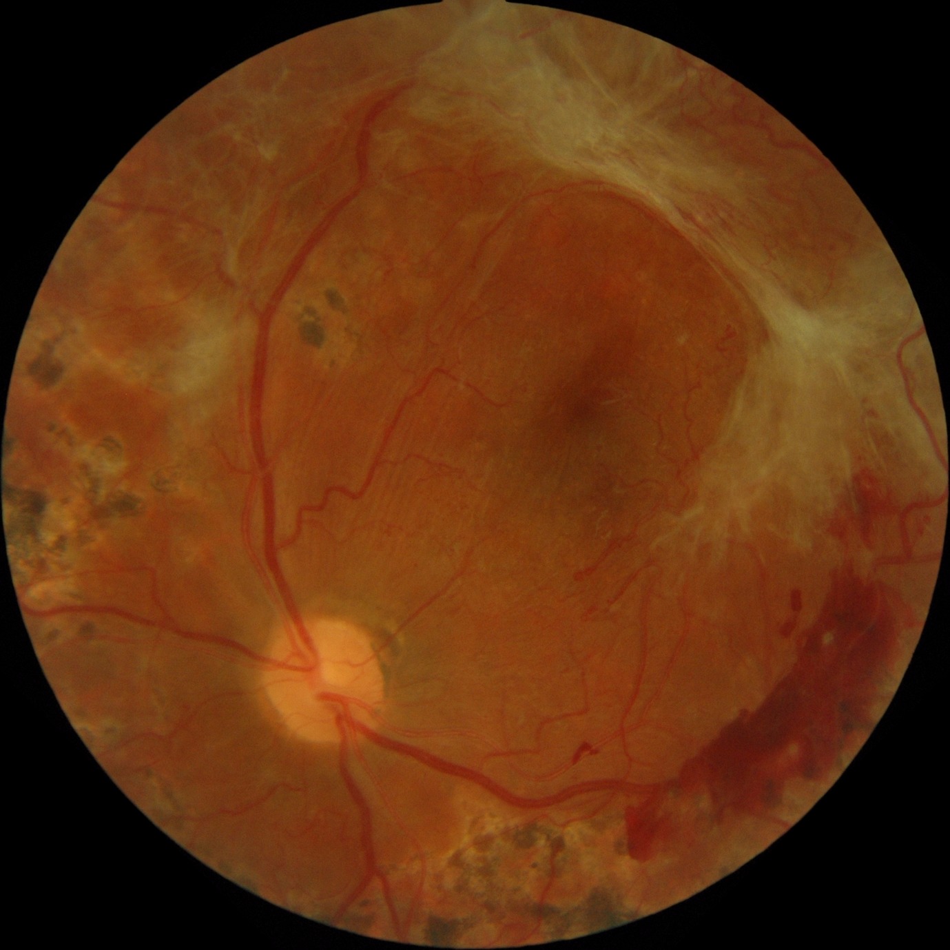 Unable To Generate Images In Tensor Board Using Keras Showing Only Black And Grey Coloured