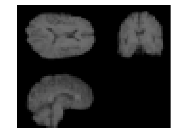 Change transformations in 3d_ddpm_tutorial · Issue #317 · Project-MONAI/GenerativeModels · GitHub
