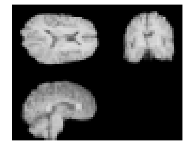 Change transformations in 3d_ddpm_tutorial · Issue #317 · Project-MONAI/GenerativeModels · GitHub
