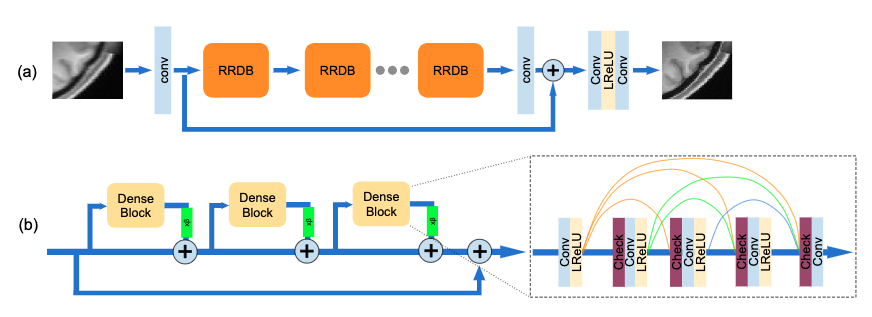 Enhanced generative adversarial network for 3D brain MRI super ...