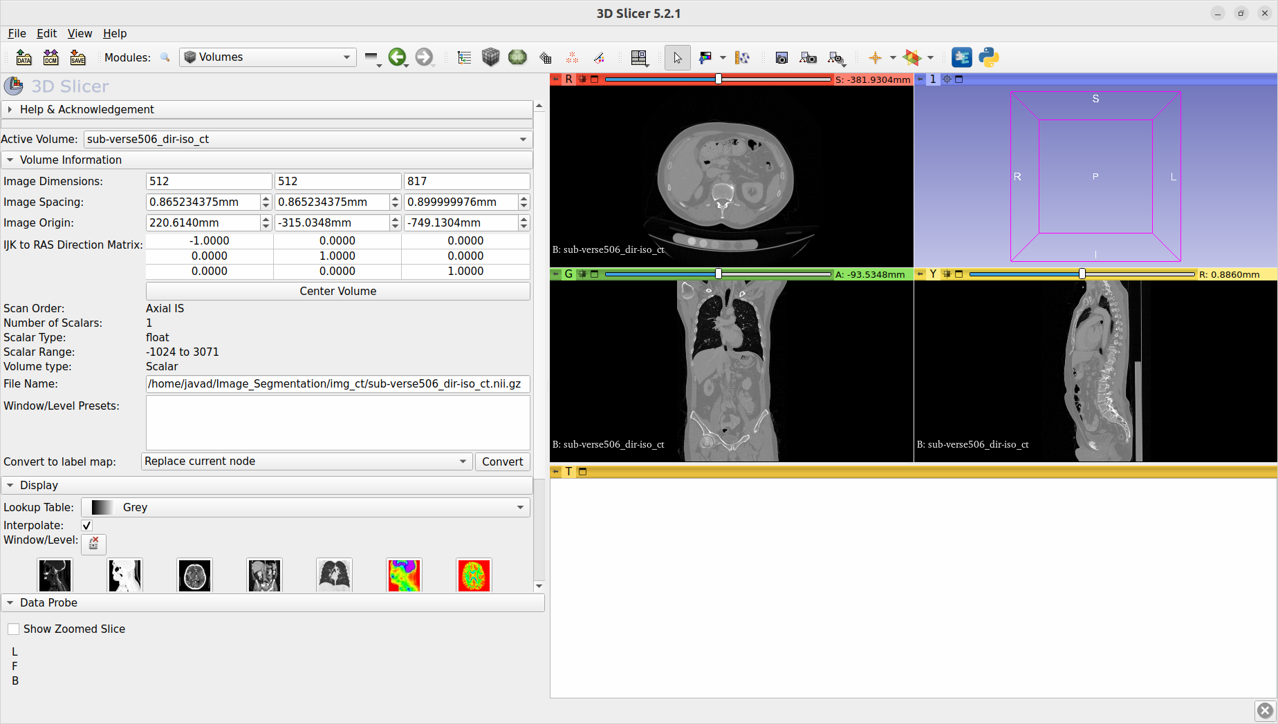 Question about reorientation · Issue #1206 · nipy/nibabel · GitHub