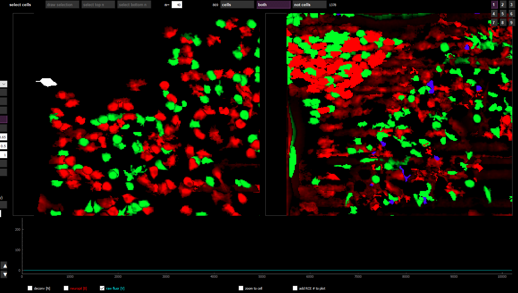 Extracted ROIs with constant F=0 · Issue #676 · MouseLand/suite2p · GitHub