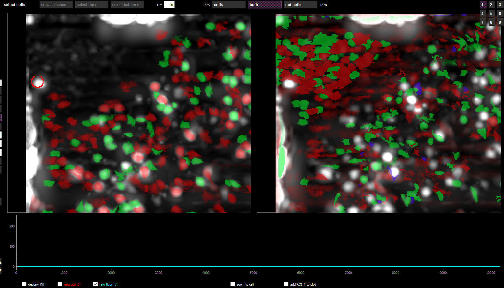 Extracted ROIs with constant F=0 · Issue #676 · MouseLand/suite2p · GitHub