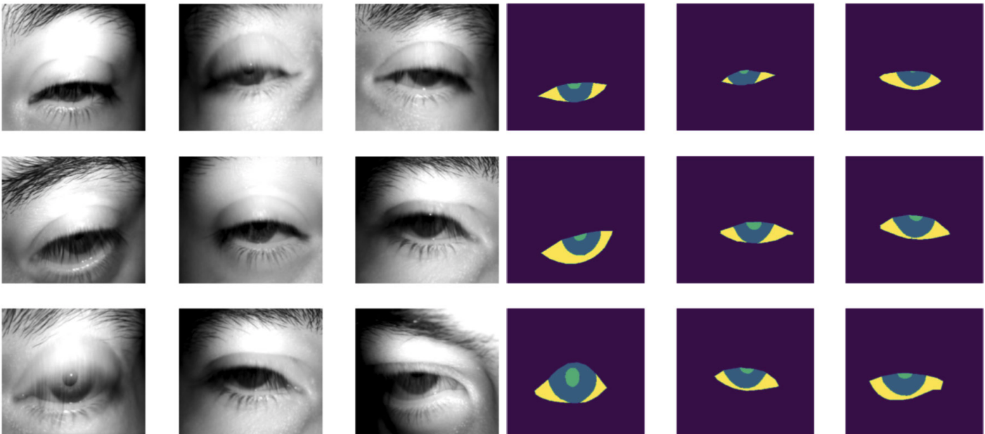 GitHub - Choapinus/DenseNet10: UNet Segmentator based on DenseNet arch