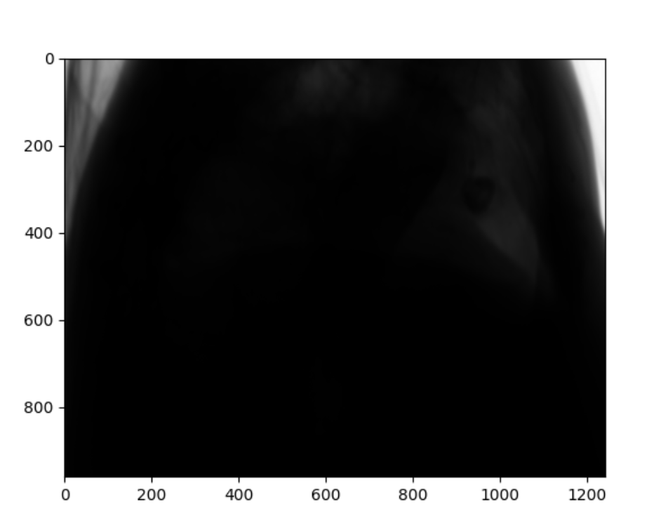 generated DRR from pelvis CT · Issue #3 · arcadelab/deepdrr · GitHub