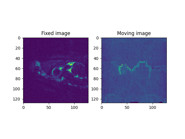 Bspline registration fails terribly · Issue #207 ...